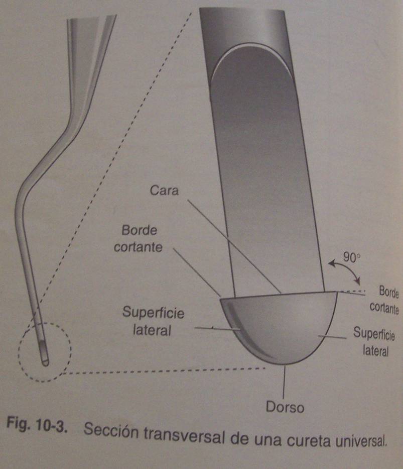 Curetas Universales | Odontoblog