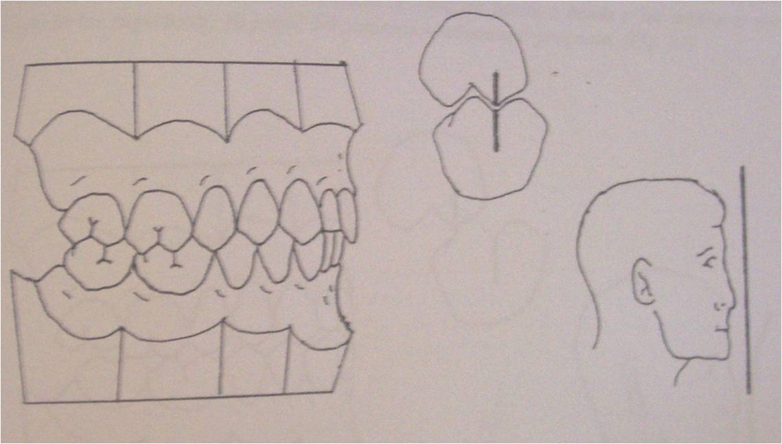 OdontoBlog » Oclusión